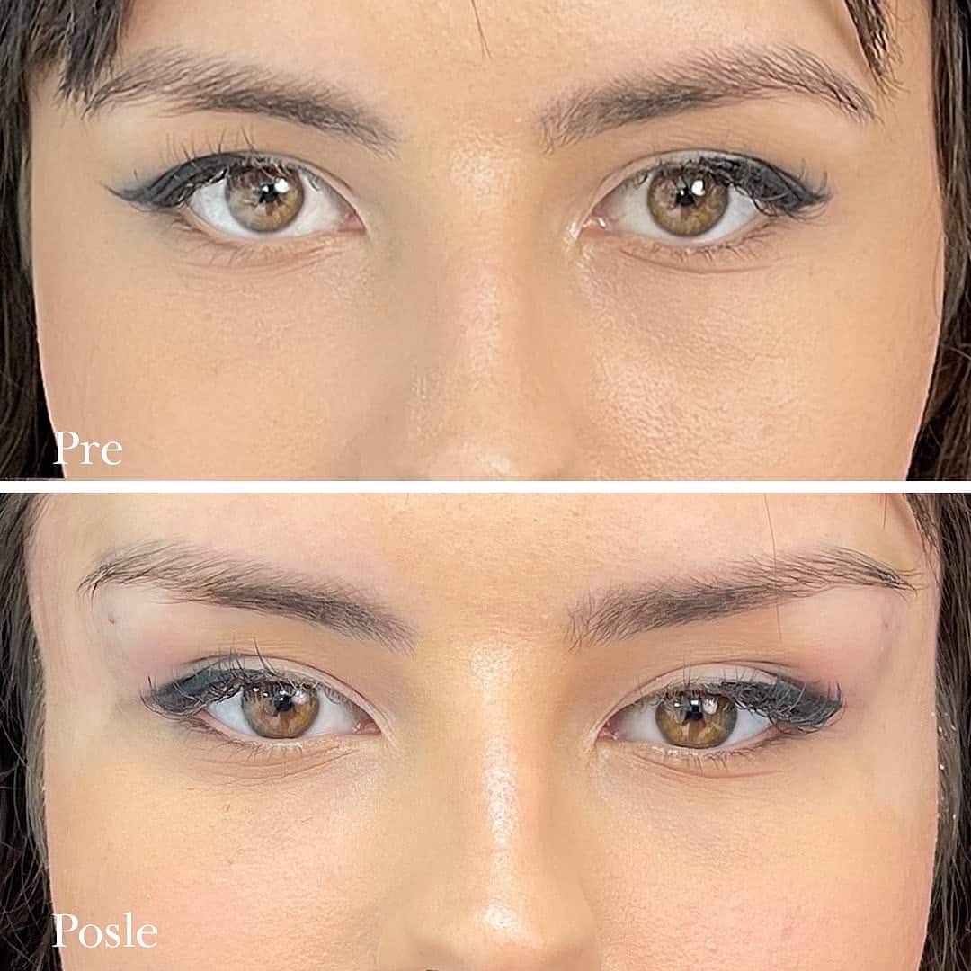 Cat Eyes - Premium Clinic Beograd